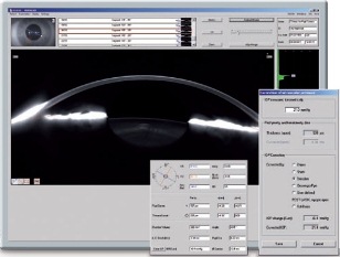 OCULUS Pentacam® – Malaysia Ophthalmic Innovator