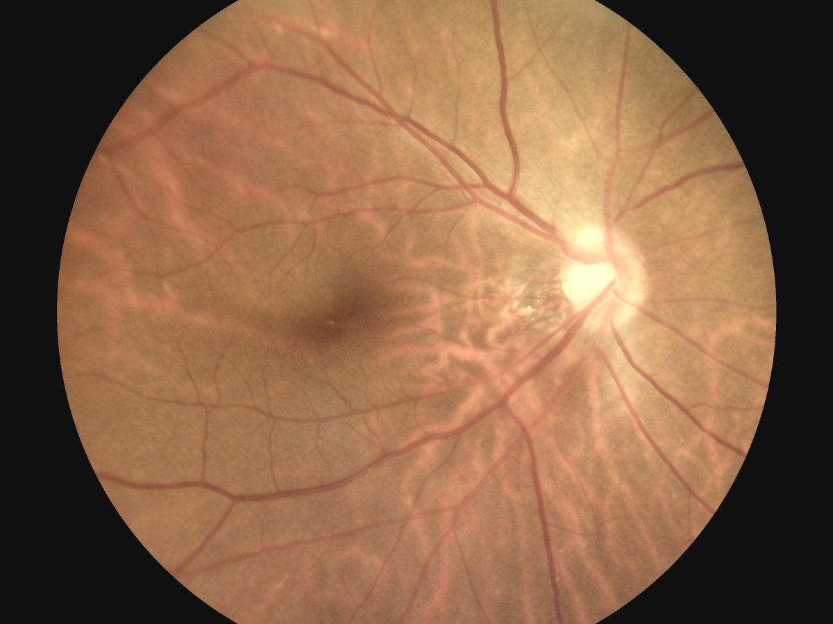 MiiS Horus Digital Fundus Camera DEC 200 (Eye Fundus Camera) – Malaysia ...