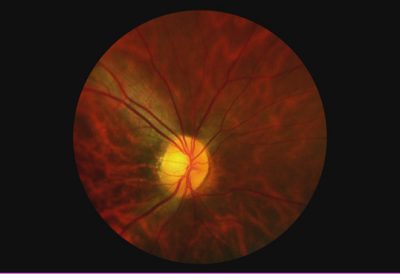 MiiS Horus Digital Fundus Camera DEC 100 – Malaysia Ophthalmic Innovator