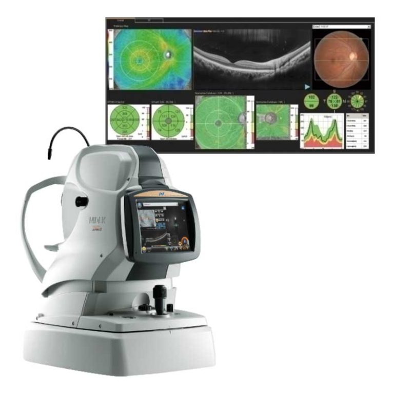 Nidek Optical Coherence Tomography RS-330 Duo 2 – Malaysia Ophthalmic ...