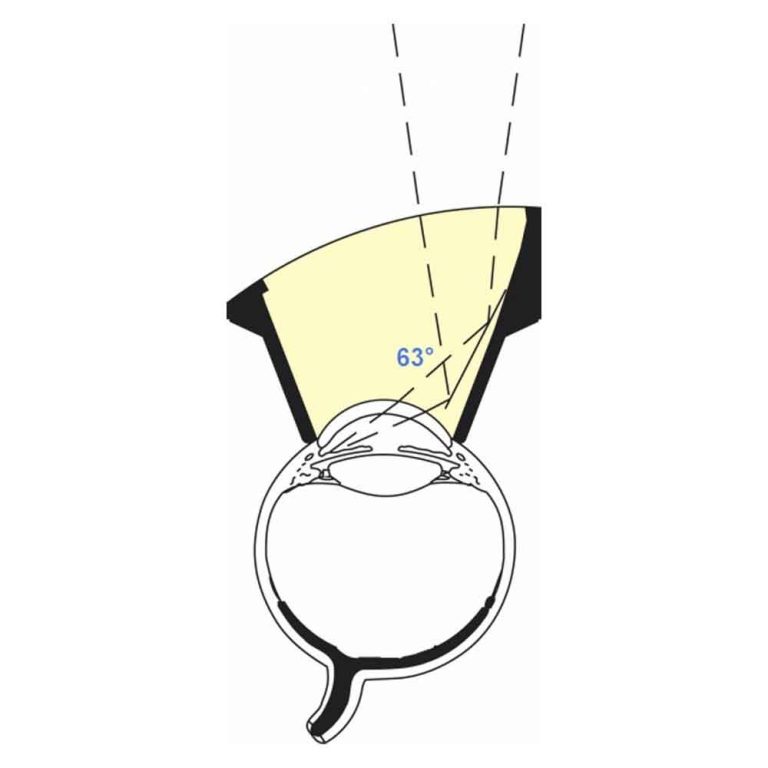 Ocular Latina SLT Gonio Laser – Malaysia Ophthalmic Innovator