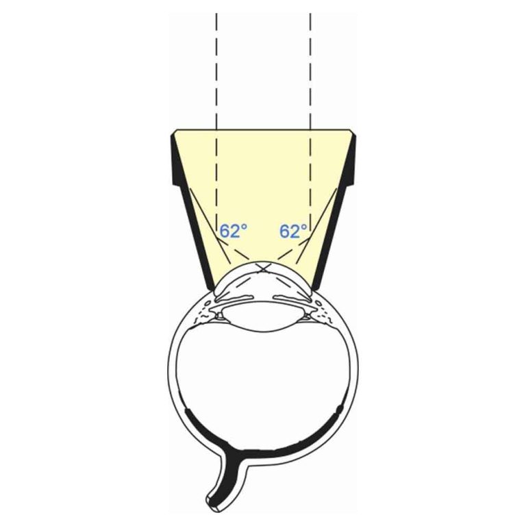 Ocular NMR-K Two Mirror Gonio Lens – Malaysia Ophthalmic Innovator